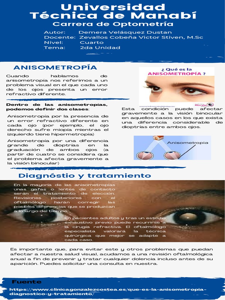 Análisis de un caso de antimetropía en un niño de 10 años | PDF ...