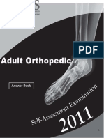 Posterior Tibial Tendon Insufficiency (PTTI) - Foot & Ankle ...