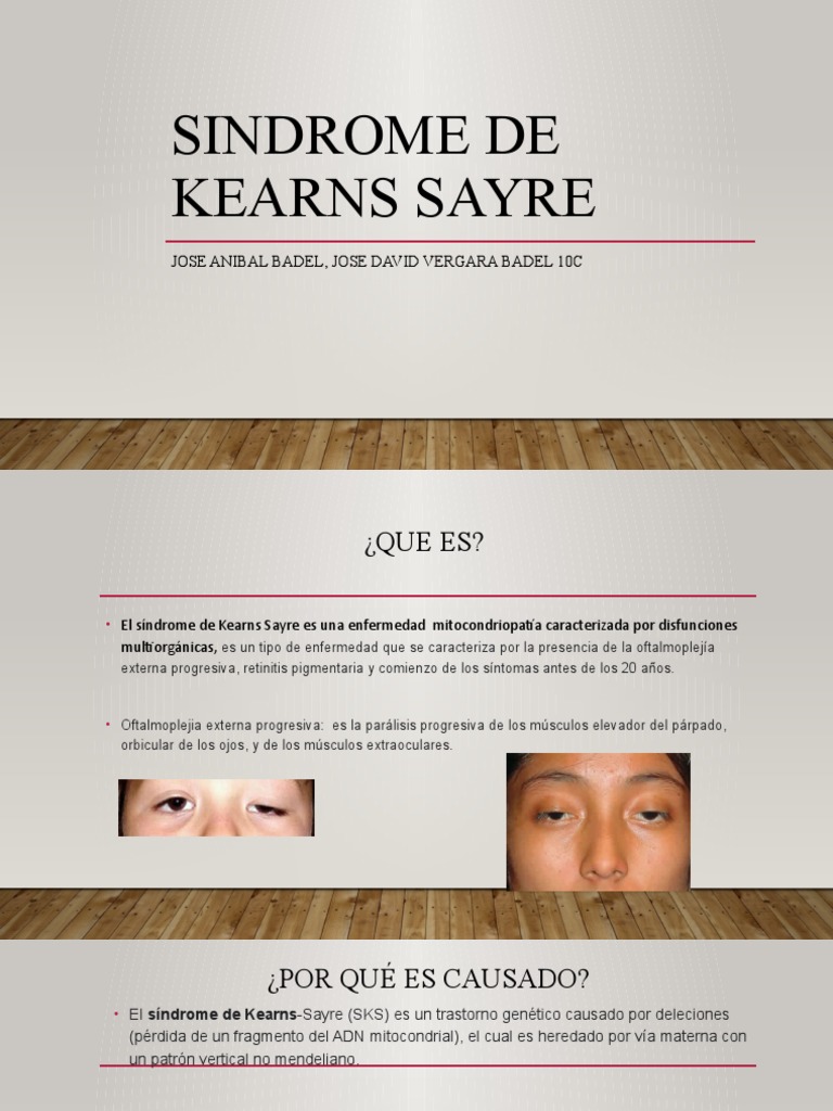 Sindrome de Kearns Sayre | PDF