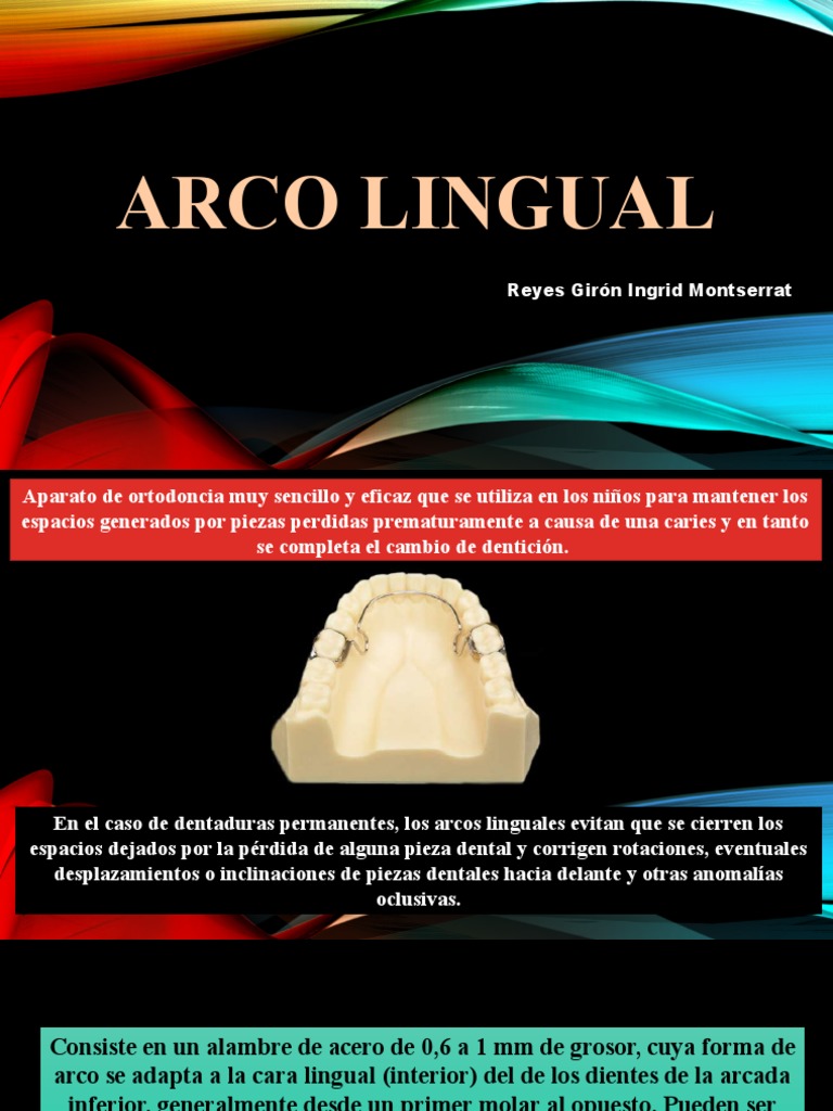 Arco Lingual | PDF | Ortodoncia | Boca