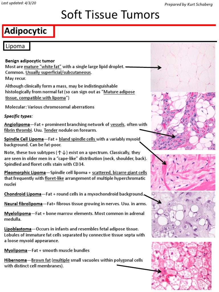 Soft Tissue Tumors: Adipocytic | PDF | Benign Tumor | Sarcoma