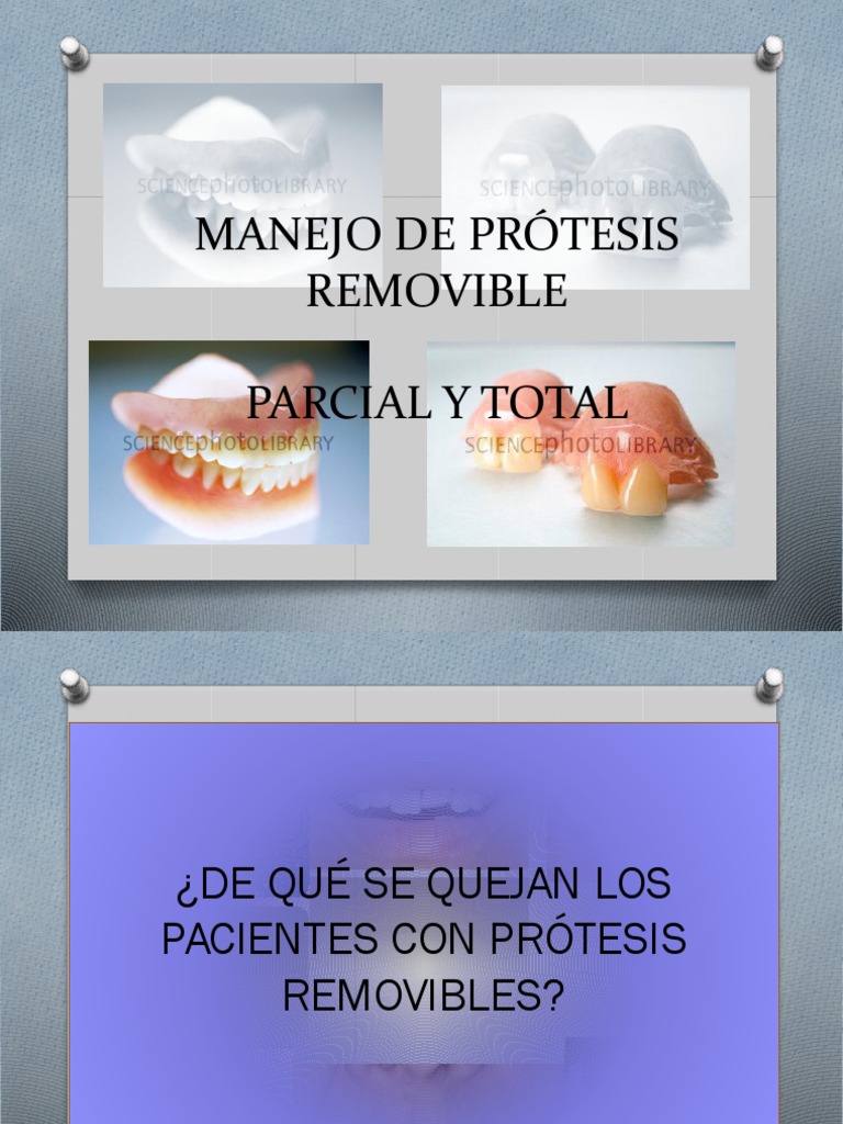 4-Protesis Totales y Removibles | PDF | Dentadura postiza | Boca