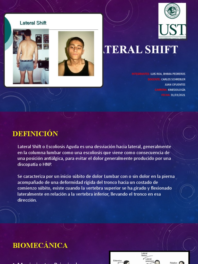 Corrección del Lateral Shift Lumbar | PDF | Escoliosis | Vértebra