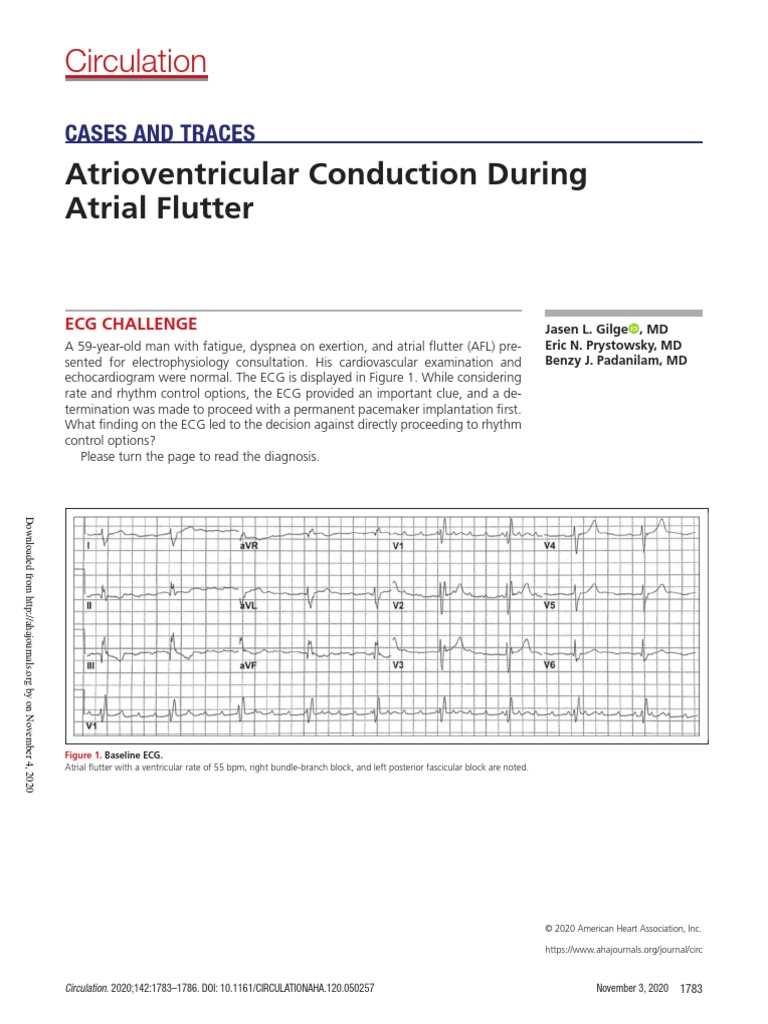 Atrioventricular Conduction During Atrial Flutter | PDF ...