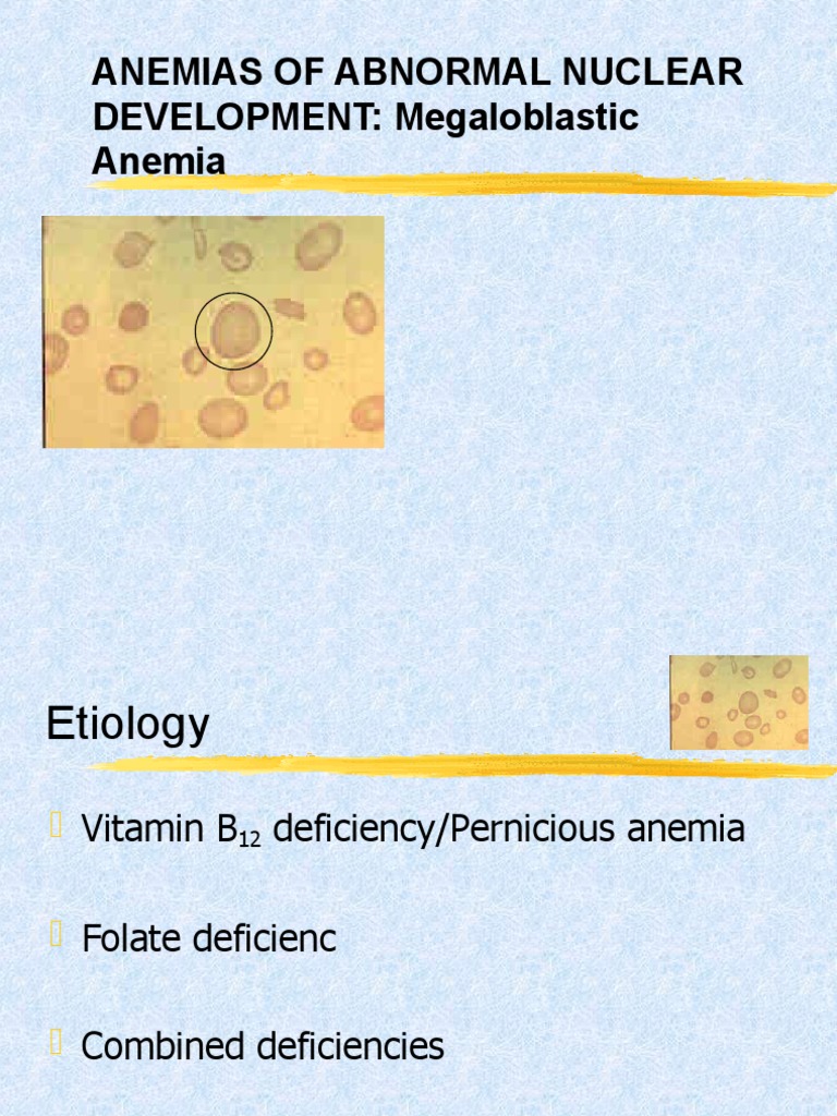 Megaloblastic Anemia Overview and Testing | PDF | Anemia | Vitamin B12