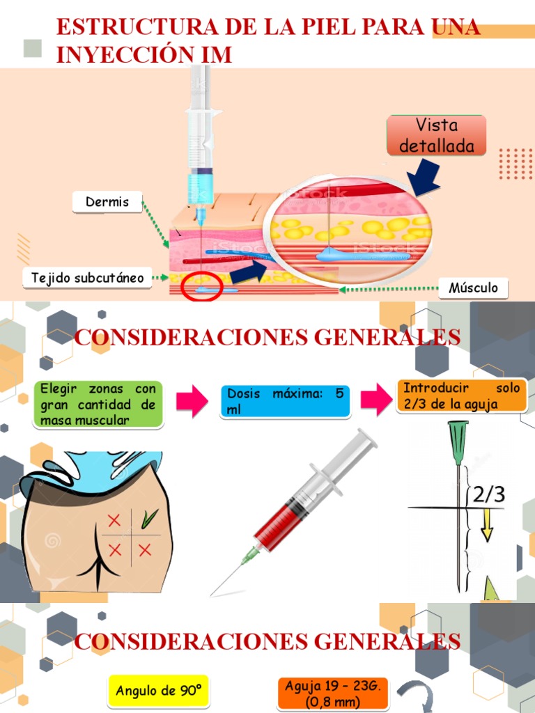 Estructura de La Piel para Una Inyección Im | PDF