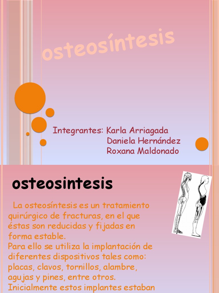 Osteosintesis | PDF
