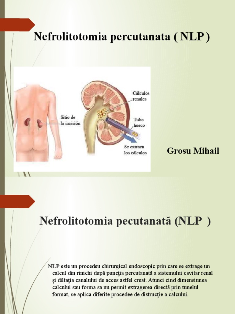Grosu Mihail - NLP | PDF