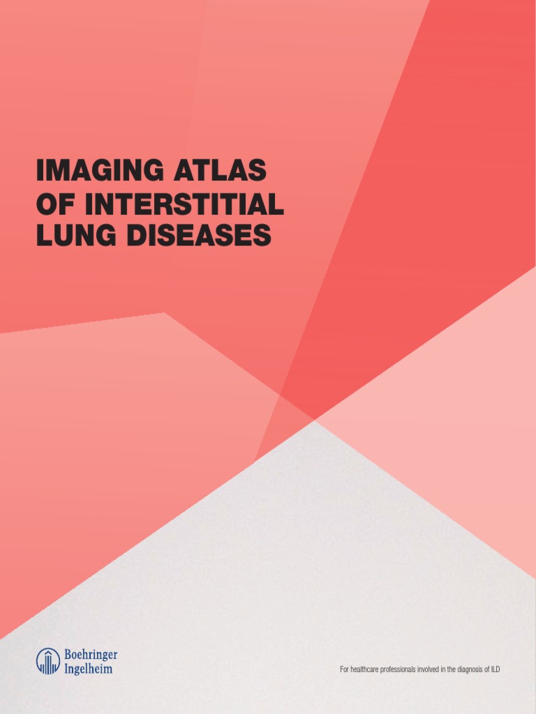 PulmonaryFibrosis360 ImagingAtlas | PDF | Pneumonia | Respiratory System