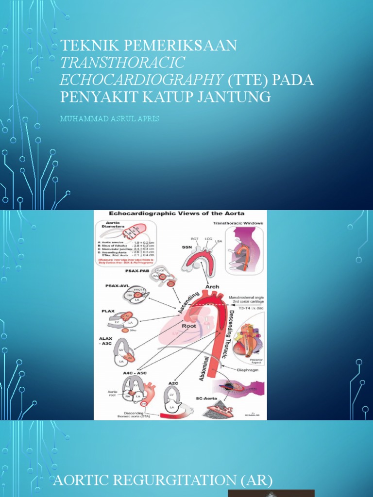 TTE Pada Regurgitasi Aorta | PDF | Medical Specialties | Diseases And ...