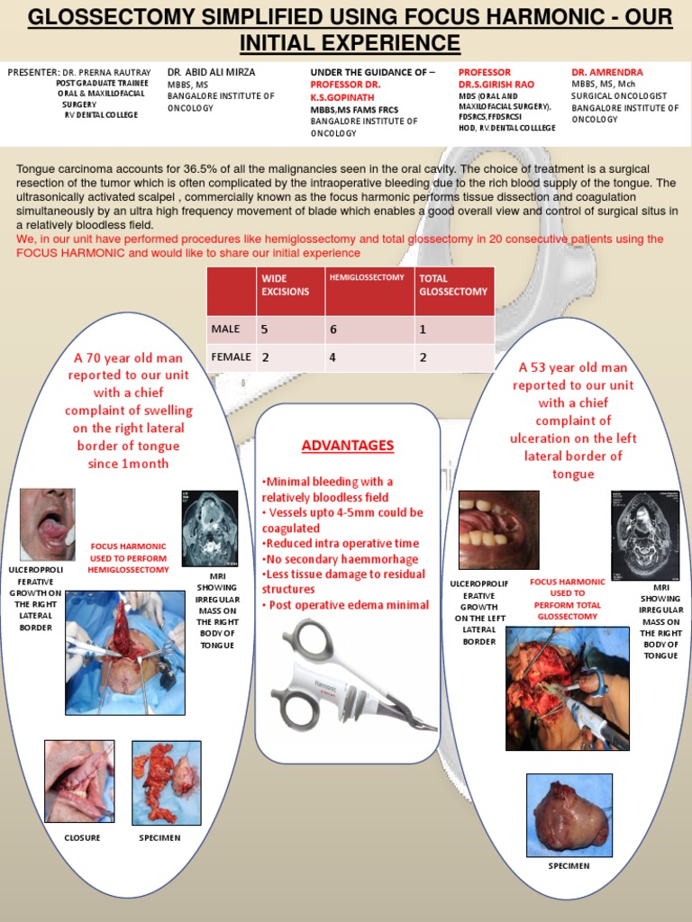HARMONIC | PDF | Surgery | Oral And Maxillofacial Surgery