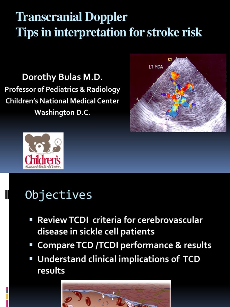 Children TCD Sicklles Cells | PDF | Stroke | Clinical Medicine