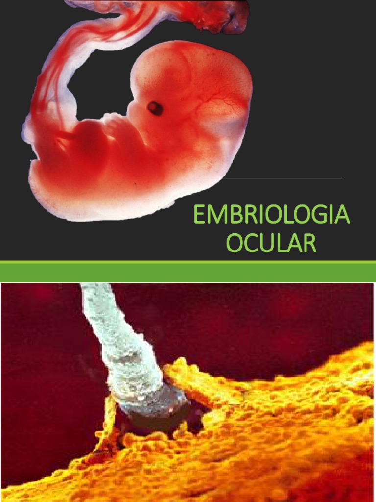 EMBRIOLOGIA OCULAR, Tercer Semestre-1-48 | PDF | Ojo humano | Retina