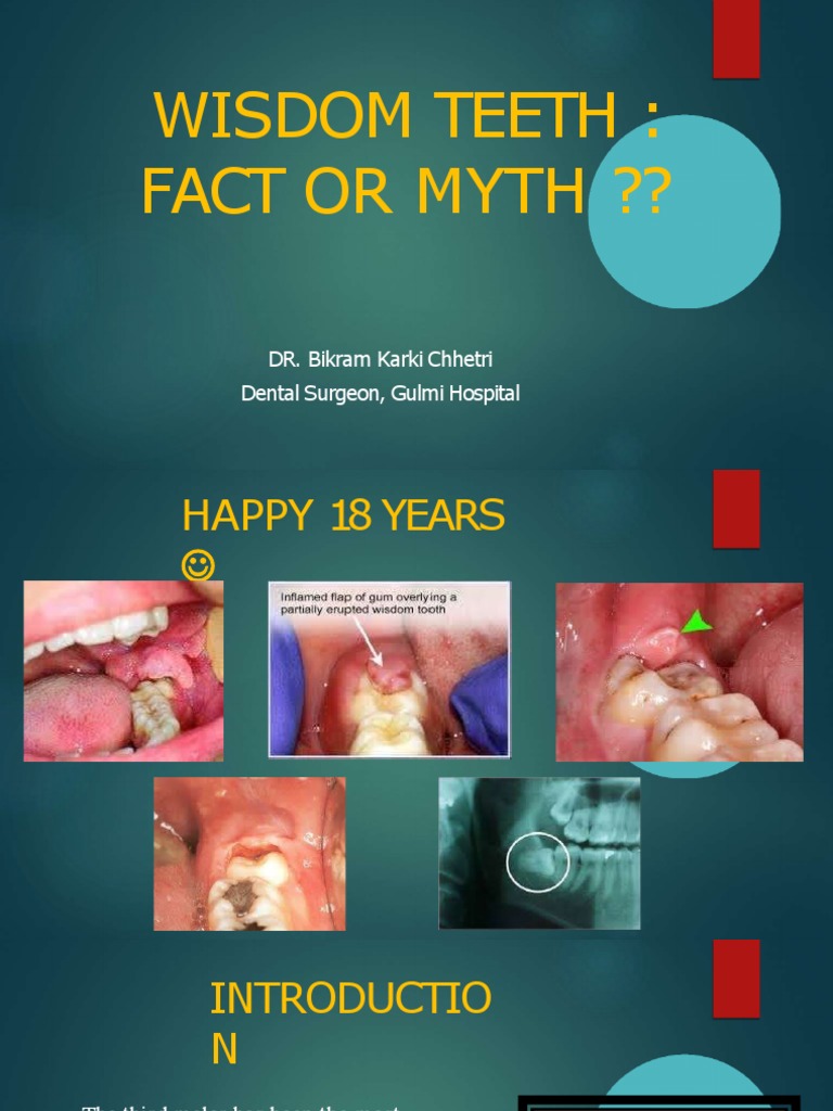 Wisdom Teeth Fact Or Myth Dr Bikram Karki Chhetri Dental Surgeon