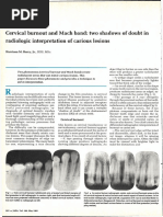 Maxillary Injections Cheat Sheet | PDF | Dentistry | Dentistry Branches