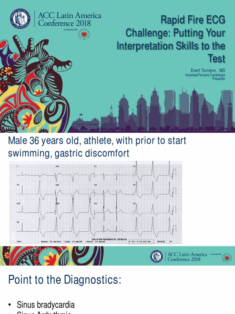 Acc Ecg Challenge | PDF | Electrocardiography | Diseases And Disorders