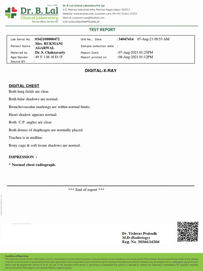 Normal Chest X-Ray Report for Mrs. Agarwal | PDF | Science & Mathematics