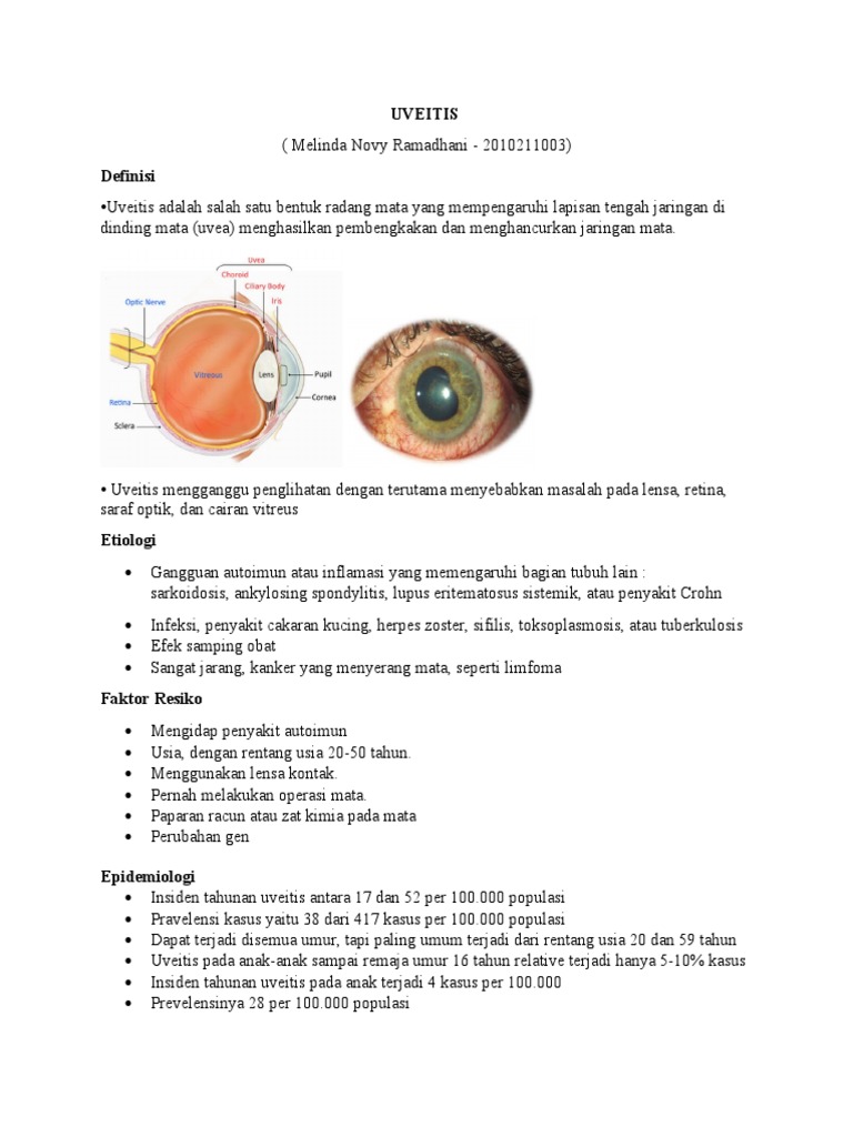 Materi UVEITIS | PDF