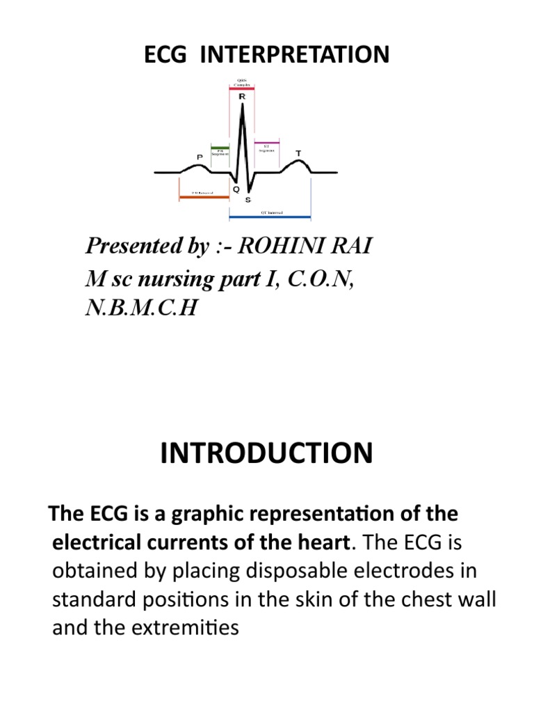 Ecg Interpretation: Presented by:-ROHINI RAI M SC Nursing Part I, C.O.N ...