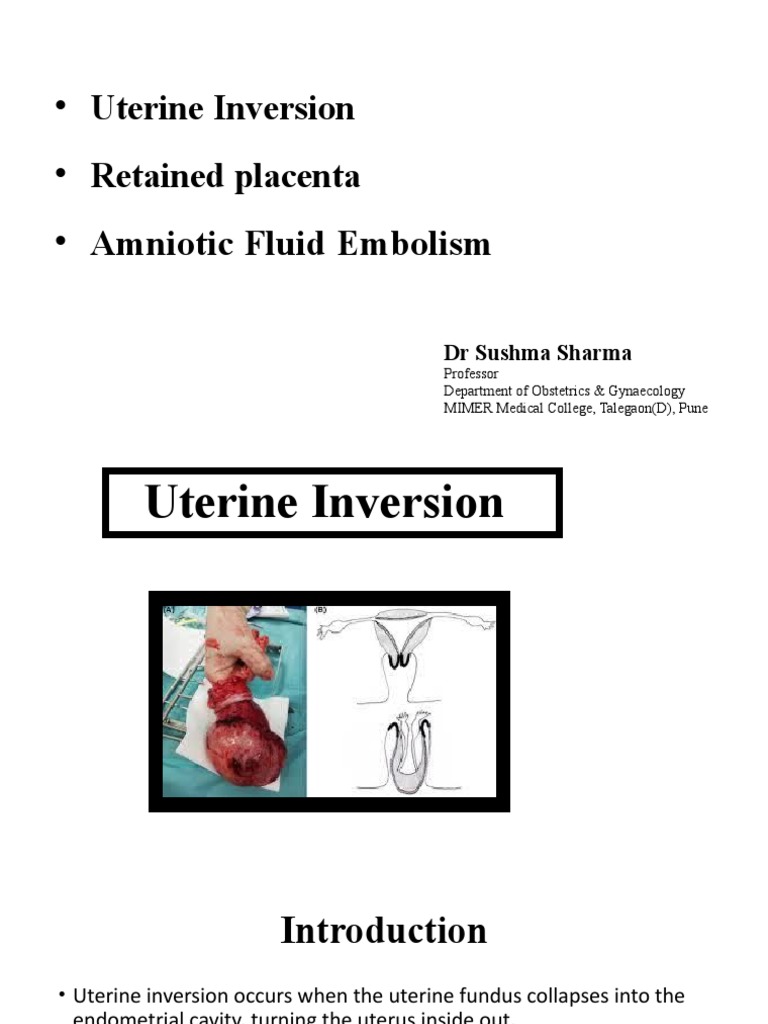 Inversion, Retained Placenta, Afe | PDF | Uterus | Childbirth