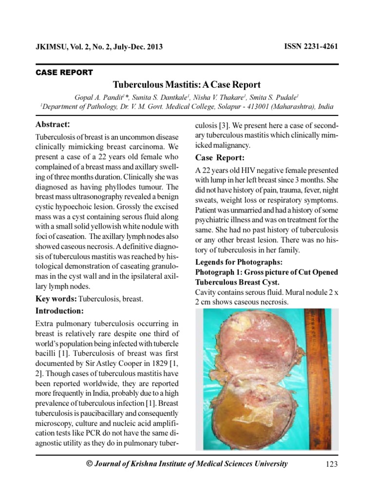 Tuberculous Mastitis A Case Report | PDF | Tuberculosis | Breast Cancer