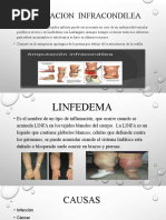 Safenectomia | PDF | Cirugía | Especialidades Medicas