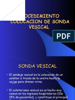 Procedimiento de Sondaje Vesical | PDF | Urología | Especialidades Medicas