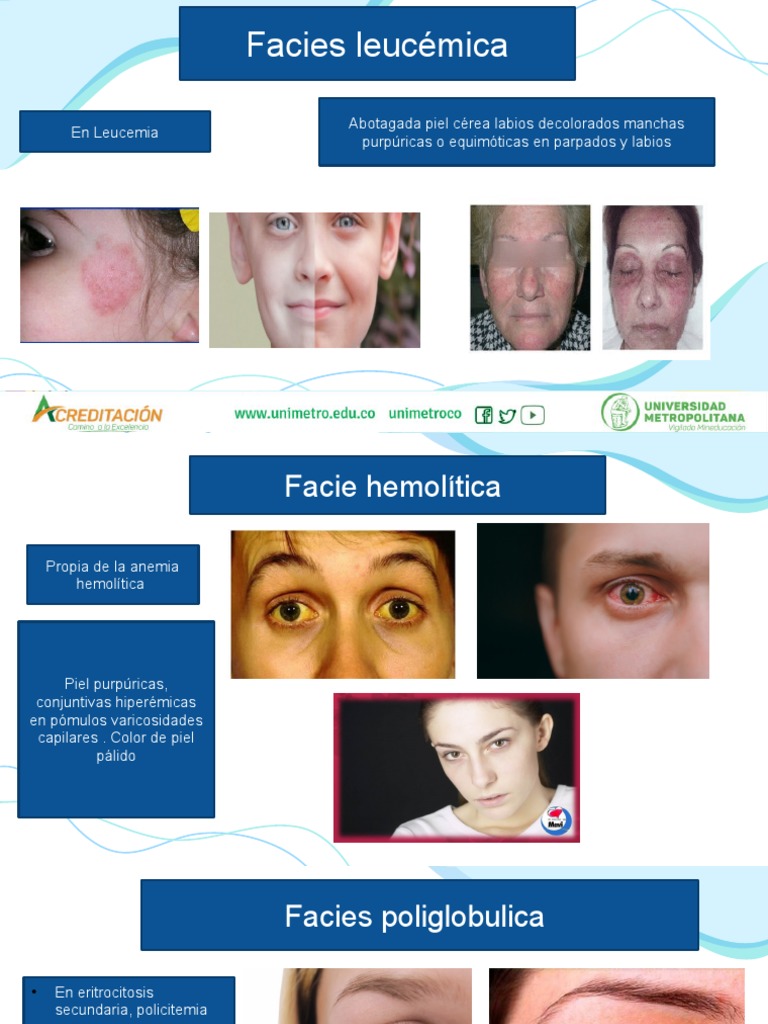 FACIES Andres Bolicar | PDF