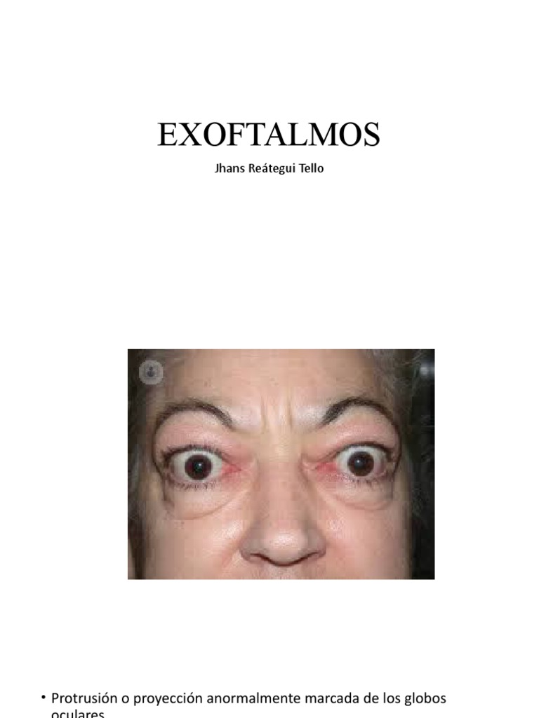 EXOFTALMOS | PDF