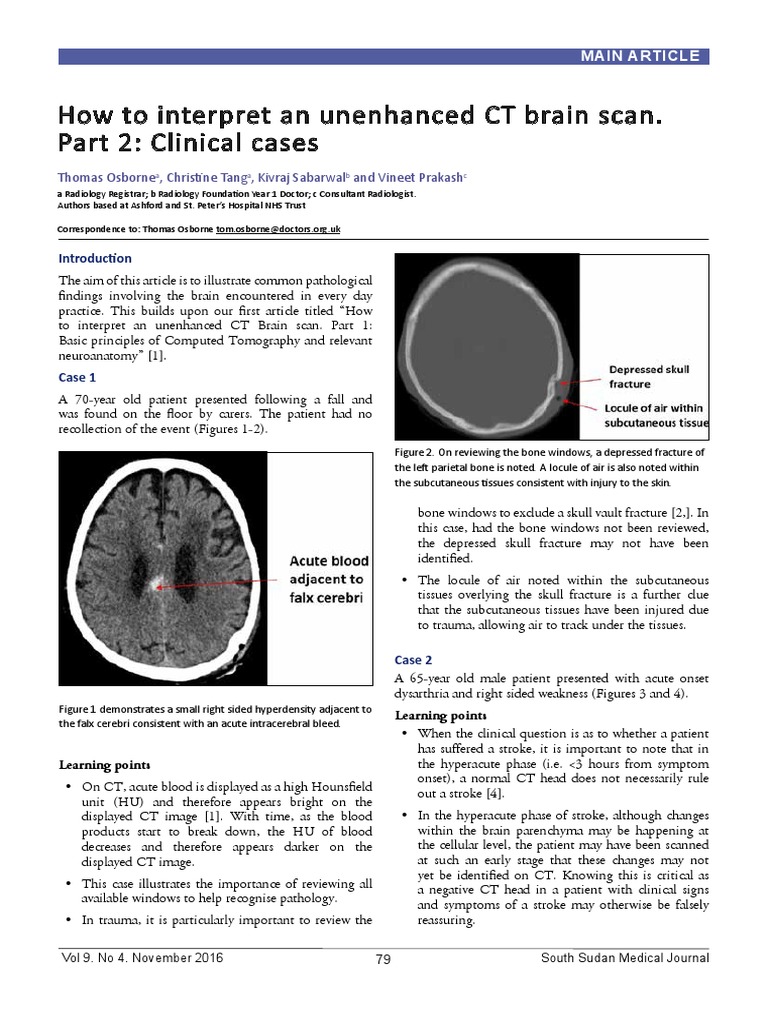 How To Interpret An Unenhanced CT Brain Scan. Part 2: Clinical Cases | PDF | Stroke | Ct Scan