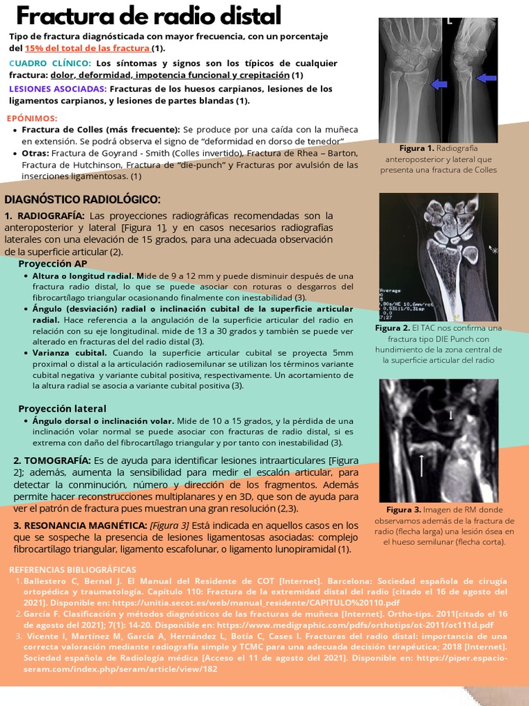 Fractura de Radio Distal | PDF | Sistema musculoesquelético | Medicina ...