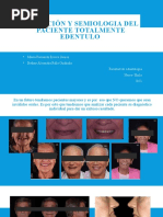 Anatomía del Paciente Edentulo | PDF | Lengua | Boca