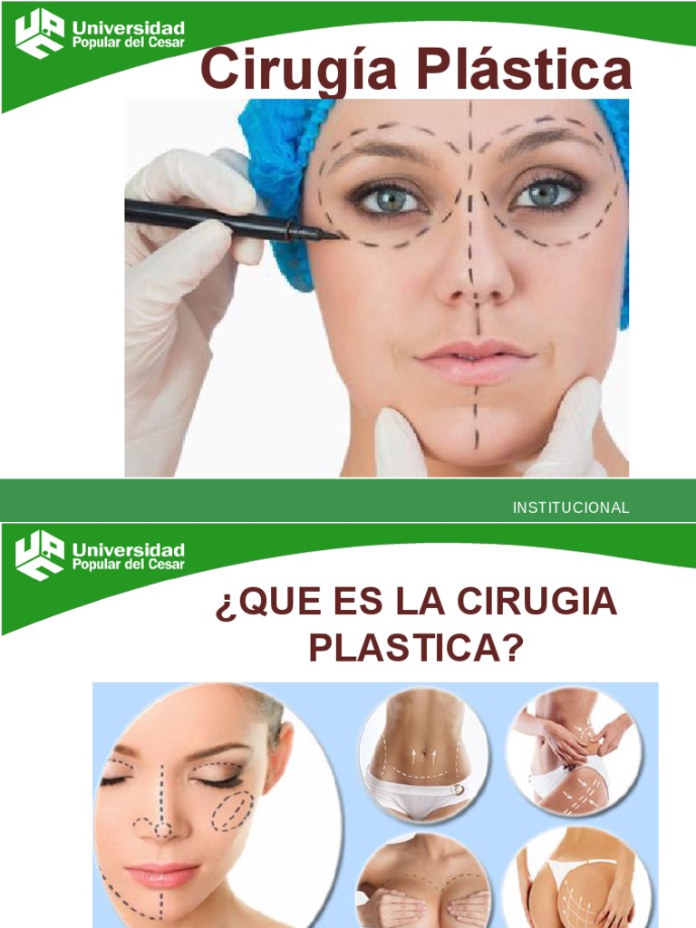 Protocolos de Cirugia Plastica | PDF | Cirugía | Cirugía plástica