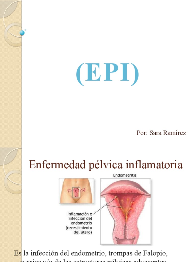 Enfermedad Pélvica Inflamatoria (EPI) | PDF | Infección transmitida sexualmente | Especialidades ...