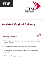Vacuum Delivery: Procedure and Complications | PDF