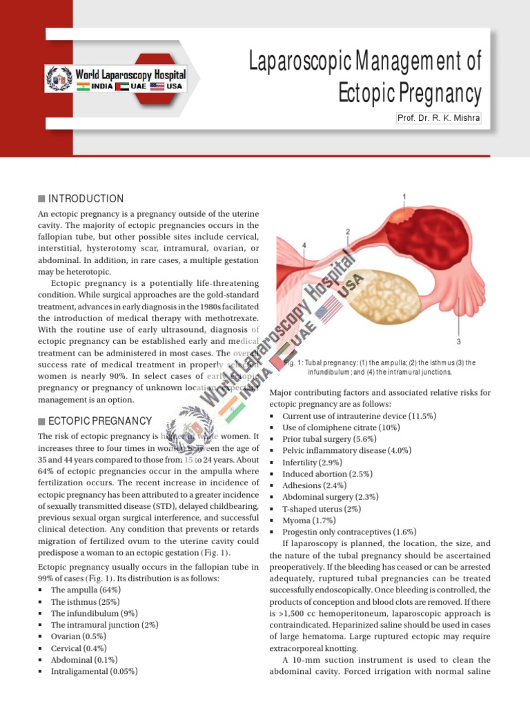 Laparoscopic Management of Ectopic Pregnancy | PDF | Health Sciences ...