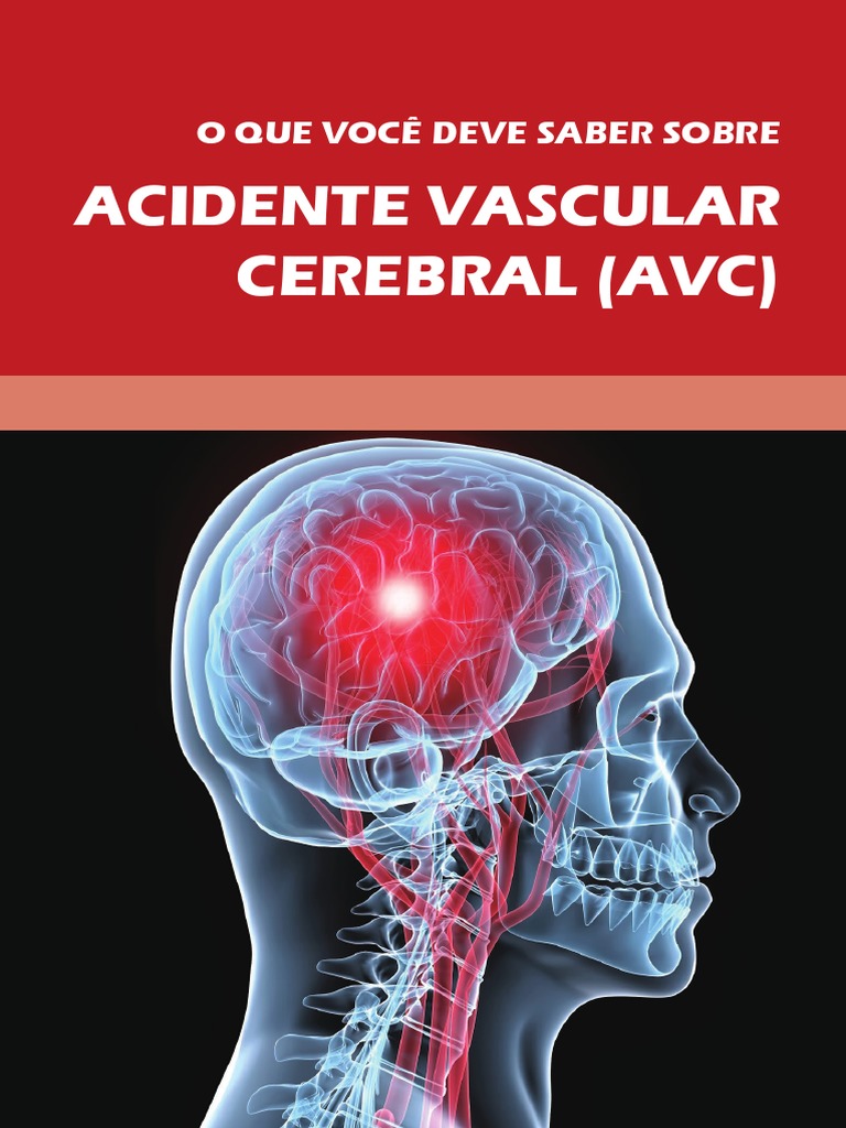 Cartilha Acidente Vascular Cerebral - 2015 | PDF | AVC | Medicina Clínica