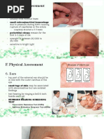 Normal Spontaneous Delivery NSD (EINC) | PDF | Childbirth | Medical ...