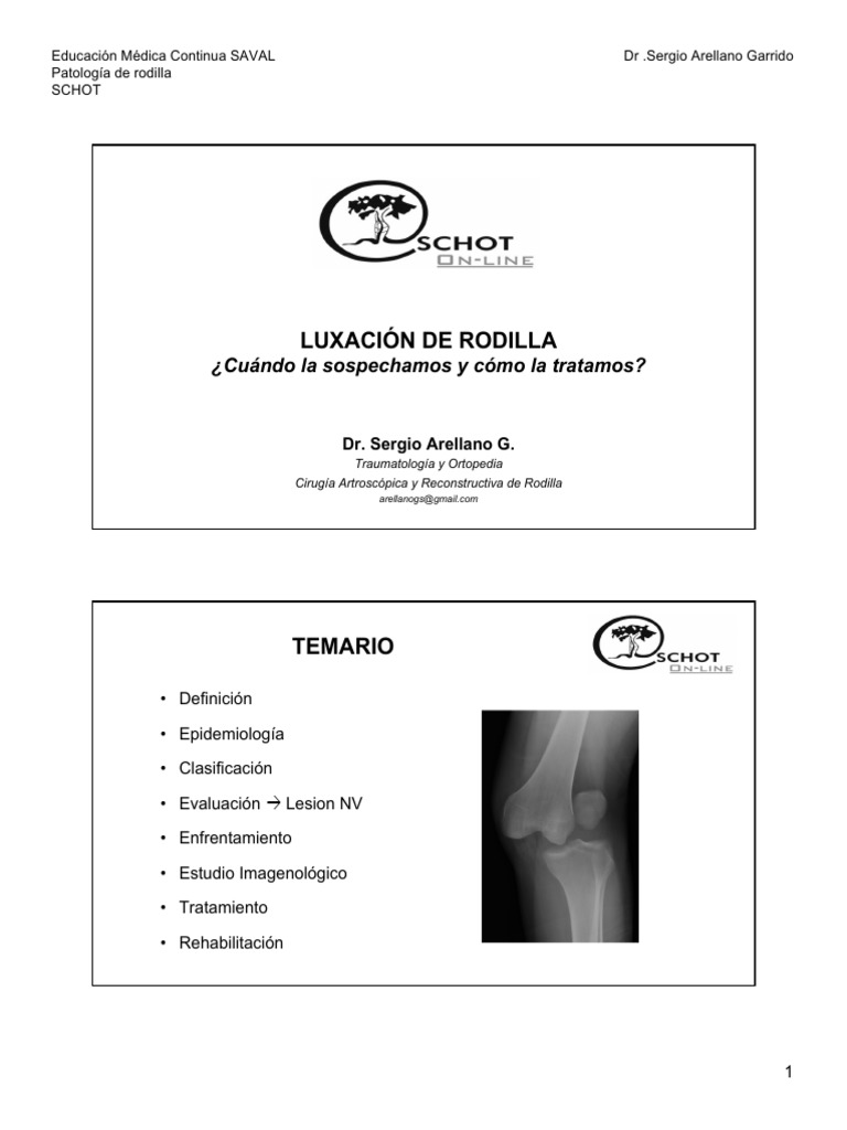 Luxacion de Rodilla | PDF | Rodilla | Neurología