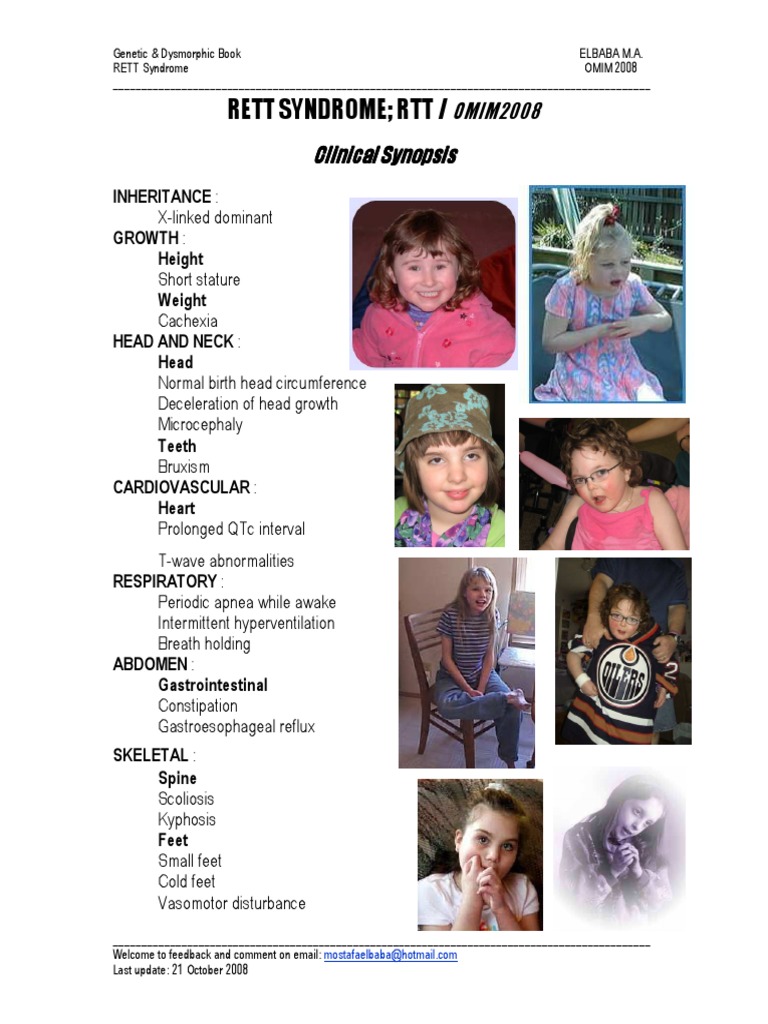 Rett Syndrome RTT /: OMIM2008 Clinical Synopsis Clinical Synopsis Clinical Synopsis Clinical ...