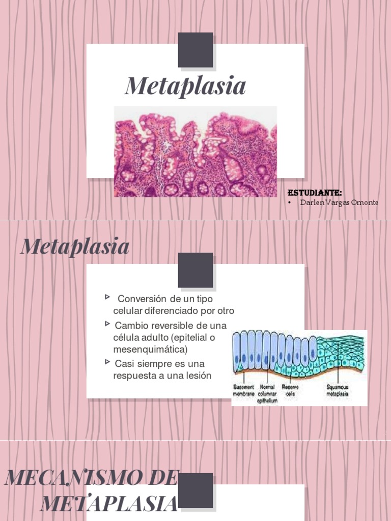 Mecanismos y Concepto de Metaplasia | PDF
