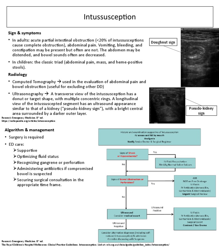 Intussusception: Sign & Symptoms | PDF