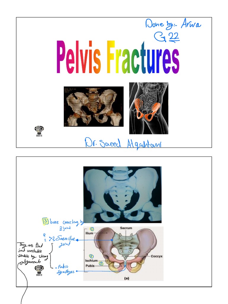 Pelvic Fracture | PDF | Pelvis | Musculoskeletal System