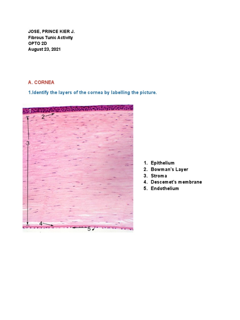 JOSE - Fibrous Tunic Activity | PDF | Cornea | Epithelium