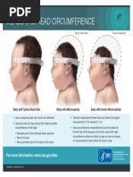 Nellhaus Head Circumference Charts | PDF