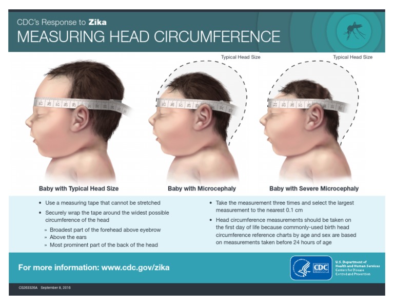 Microcephaly Measuring | PDF