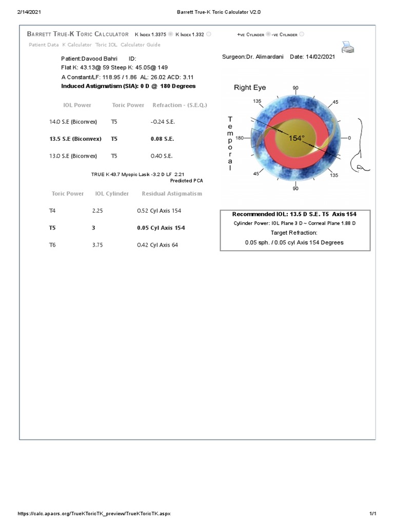 Barrett True-K Toric Calculator V2.0 | PDF