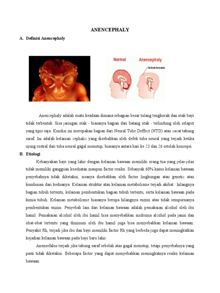 ANENCEPHALY | PDF