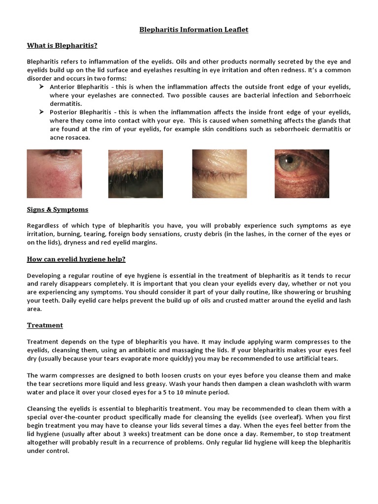 Patient Blepharitis Leaflet | PDF | Clinical Medicine | Ophthalmology