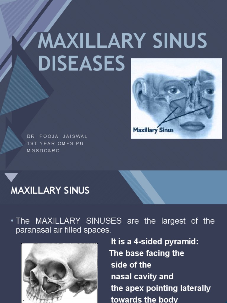 Maxillary Sinus | PDF | Human Nose | Medical Specialties